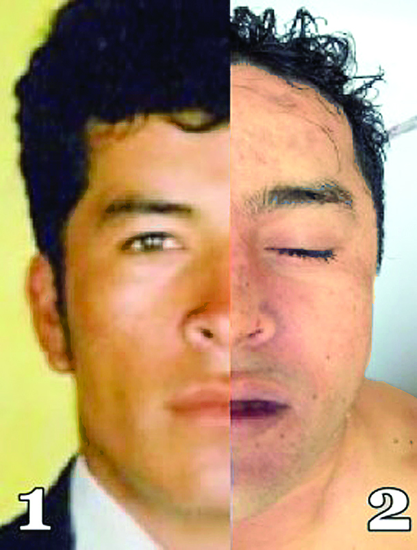 Ni rastros del del cadáver de “El Lazca” – El Buen Tono